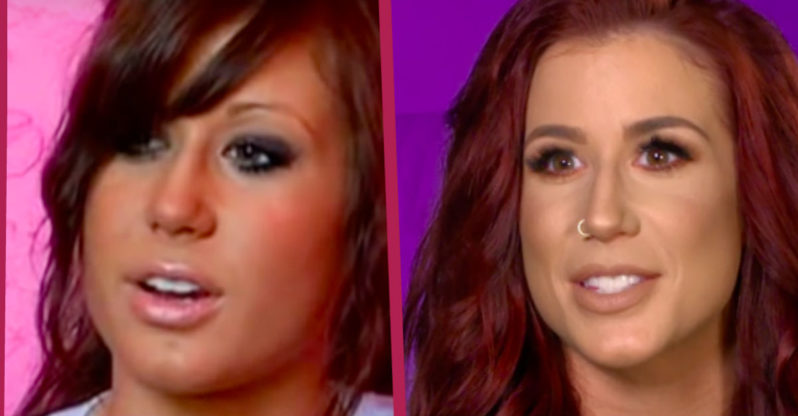 Plastic Surgery | Celebuzz