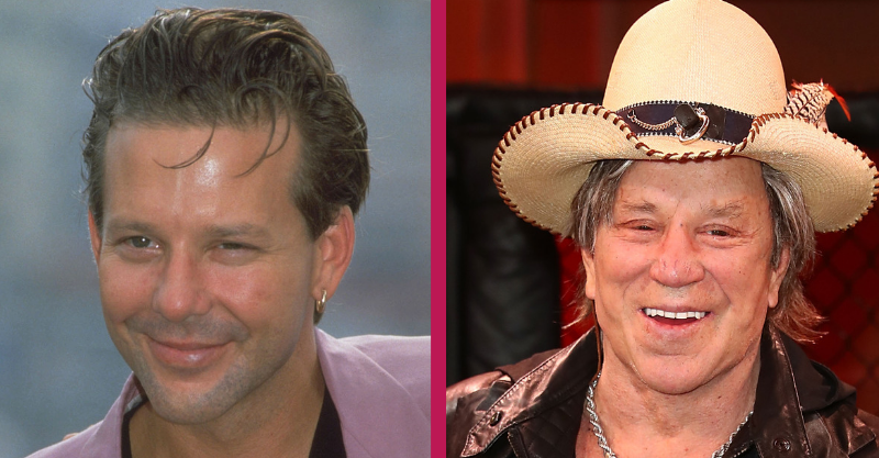 This Actor is Unrecognizable After His Plastic Surgery | Celebuzz